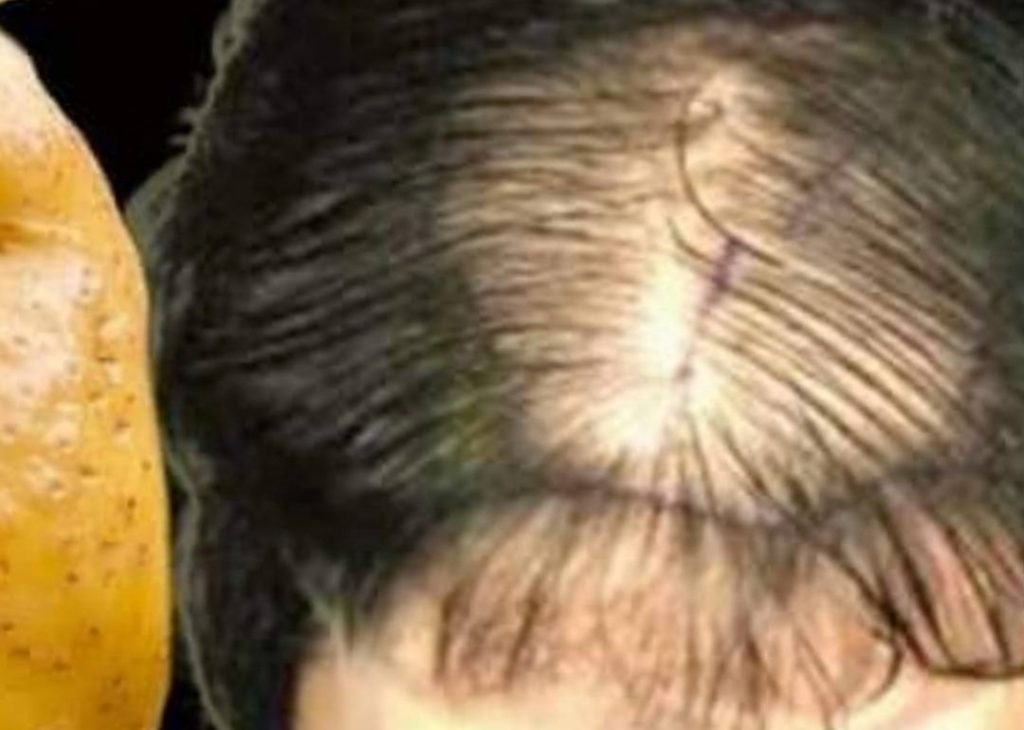 Hair Grows Like Crazy and Doesn’t Fall Out! Discover the Powerful ...